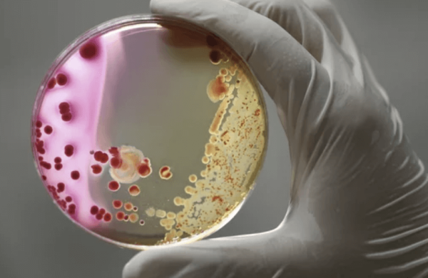 Gonorrhea: The Clap - CondomDepot.com